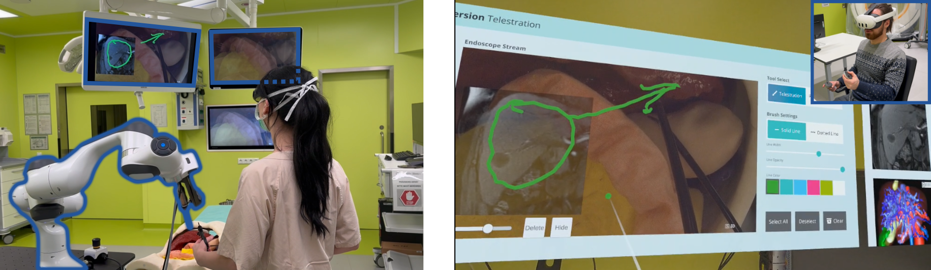 Endomersion – An Immersive Remote Guidance and Feedback System for Robot-Assisted Minimally ...